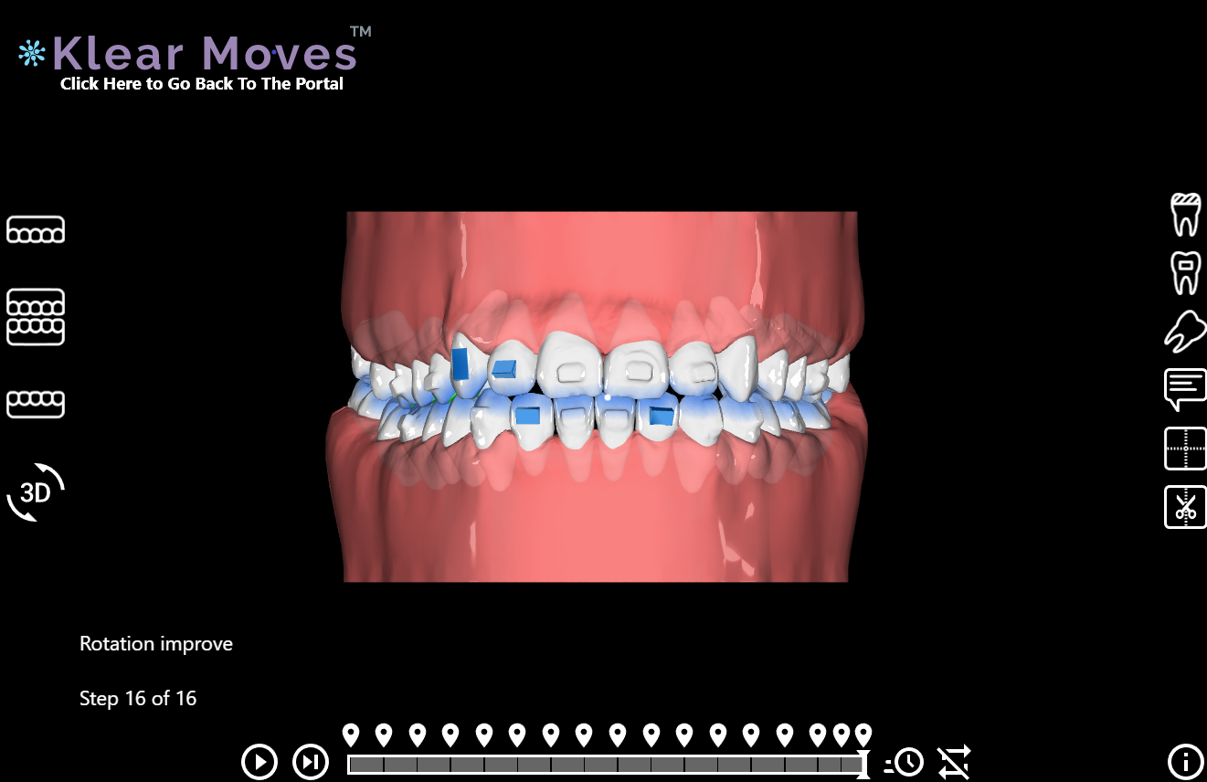 Doctor Guide – White Label Aligner Consultants and Manufacturing